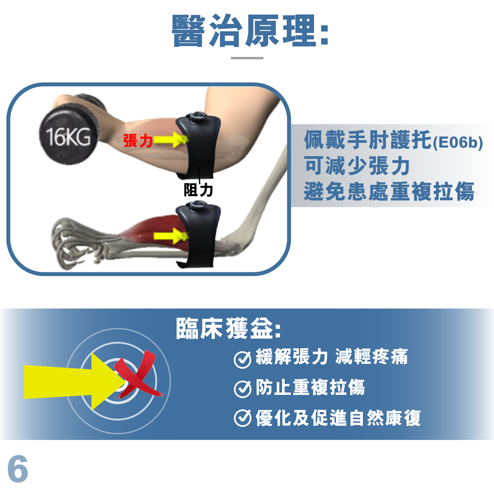 Medex E06b - Tennis Elbow Clasp (Universal) Cinch Device 手肘護托 (附微調拉繩器 ...