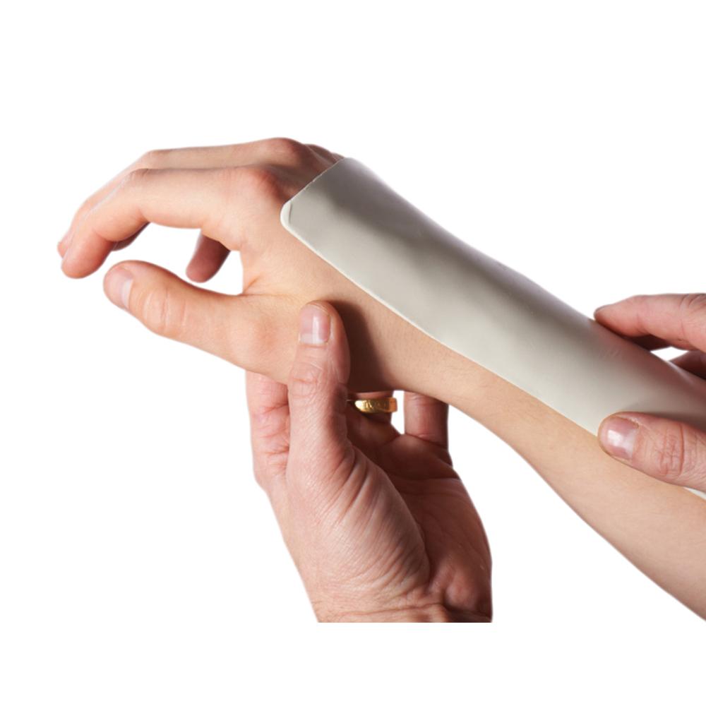 Mediroyal Manex Radial Hand Splint - Radial Nerve Palsy Hand Splint ...
