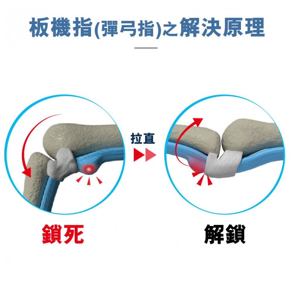 Medex H15b - Trigger Finger Splint (with cinch device) 夜用板機指矯形護托(附微調拉繩器 ...