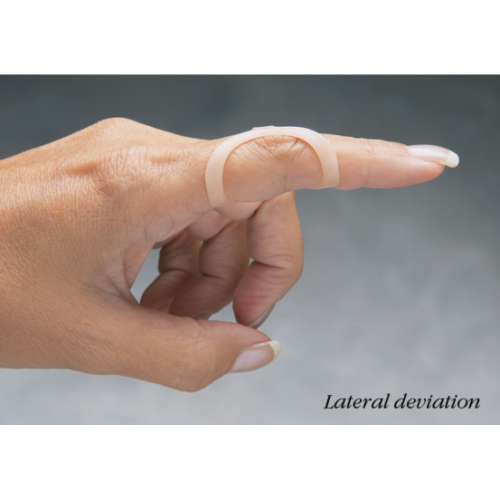 Oval-8 Mallet Finger Splint Singapore - Oval 8 Trigger Finger Splint ...
